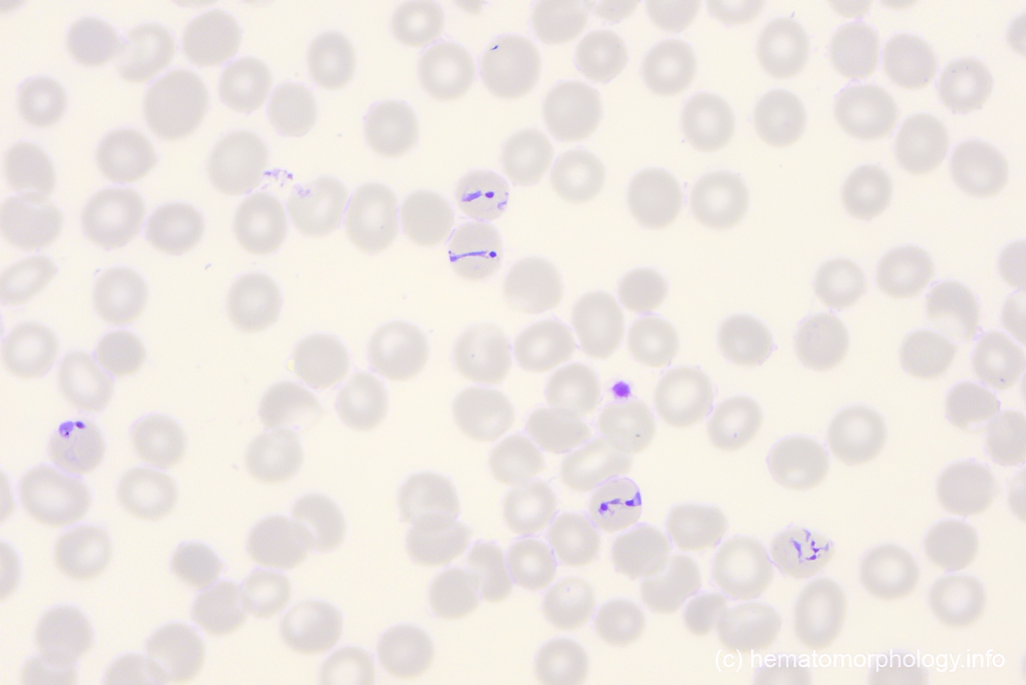 P. Knowlesi - Hematomorphology, a databank / imagebank for hematology ...