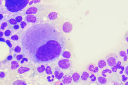Demo 1: Different megakaryocytes - Hematomorphology, a databank ...