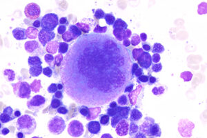 Demo 1: Different megakaryocytes - Hematomorphology, a databank ...