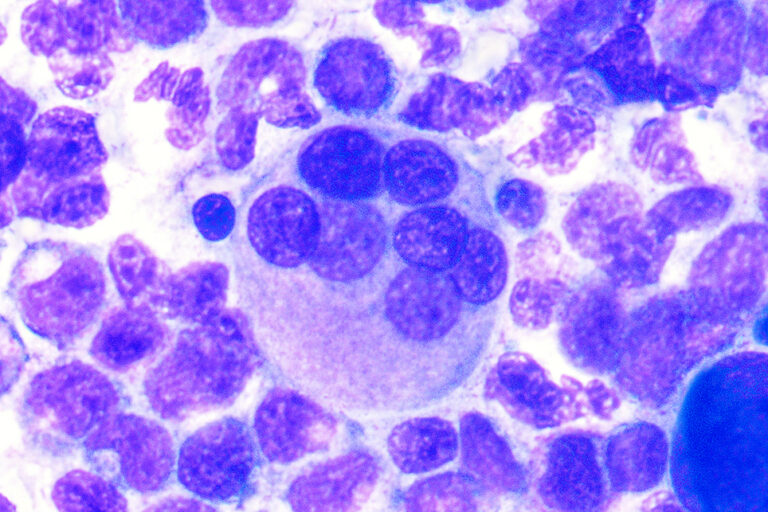 Demo 1: Different megakaryocytes - Hematomorphology, a databank ...