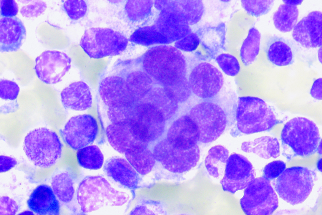Demo 1: Different megakaryocytes - Hematomorphology, a databank ...